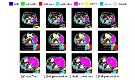 for visualization of the number of skip connections on multi organ