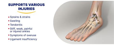 Buy Elastoplast Performance Ankle Support Lxl Online At Chemist Warehouse