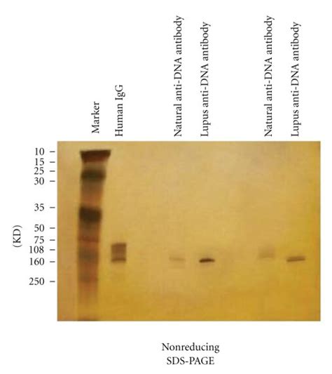 Electrophoretic Analysis Of The Purity Of Anti Dna Antibody Purified