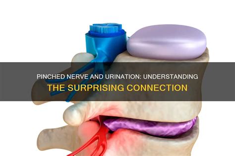 Pinched Nerve And Urination Understanding The Surprising Connection