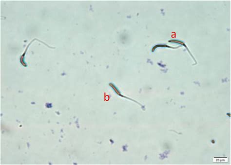 Sperm Acrosome Morphology After Freezing 400 × Observation Under Download Scientific Diagram
