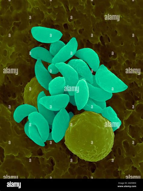 Parasitic Tachyzoites Trophozoites That Cause Toxoplasmosis In Humans