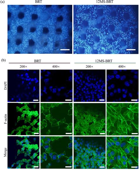 3d Printed Bioactive Ceramic Scaffolds With Mose 2 Nanocrystals As Photothermal Agents For Bone