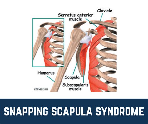 The Scapulothoracic Joint Is Located Summit Orthopaedics