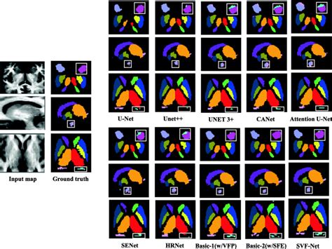 2d brain structure segmentation visualization comparing the proposed