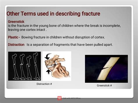 Definition Of Fracture Its Types Symptoms And Treatment Pdf