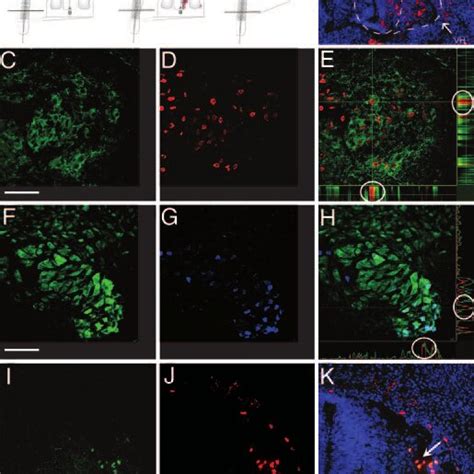 Expression Of Neuronal Markers By Human Cells After Integration Into
