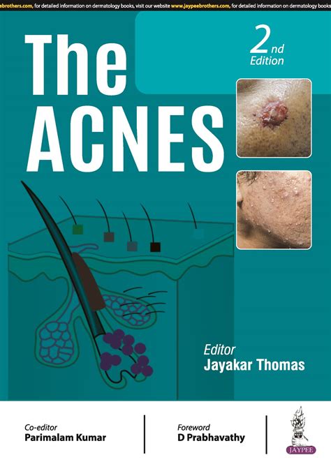 The Acnes Εκδόσεις Κωνσταντάρας