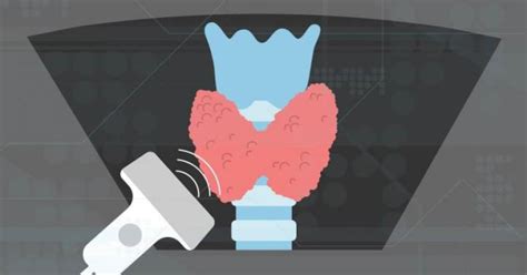 Which Risk Stratification System Is Best For Classifying Thyroid Nodules