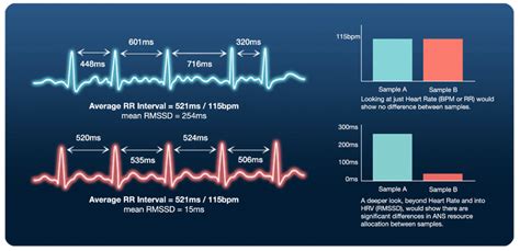 Example Of R R Intervals In Milliseconds Duration Between R Peaks From Download Scientific