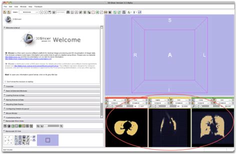 modules mribiasfieldcorrection documentation 3 6 slicer wiki