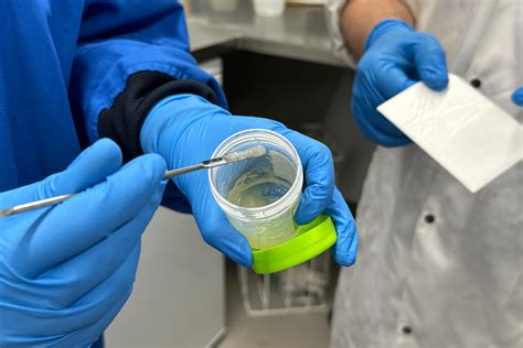 Phosphorus Based Nanotech Rips Apart Superbugs And Accelerates Healing