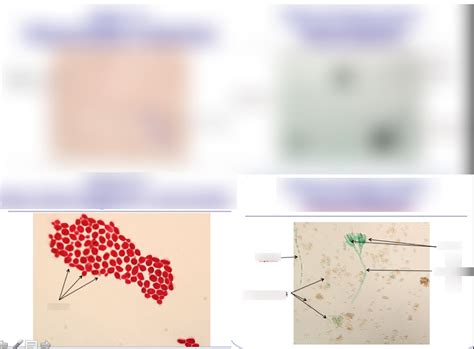 Micro Lab Midterm Diagram Quizlet