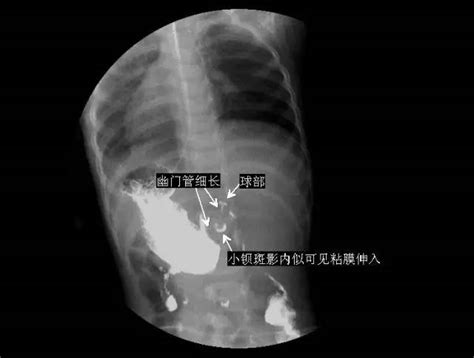 腔内龛影 壁内龛影 大山谷图库