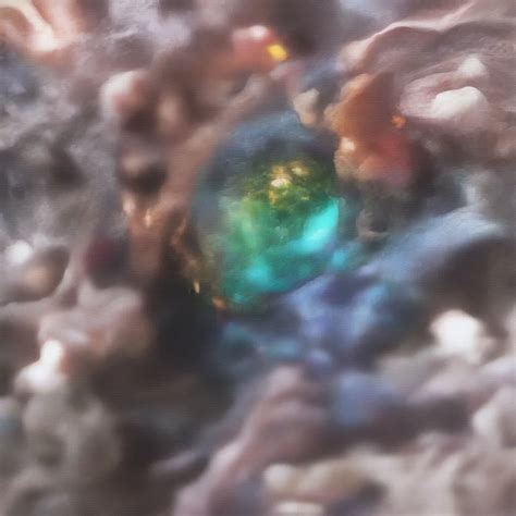 Diffuse Midline Glioma Treatment Approaches And Trends