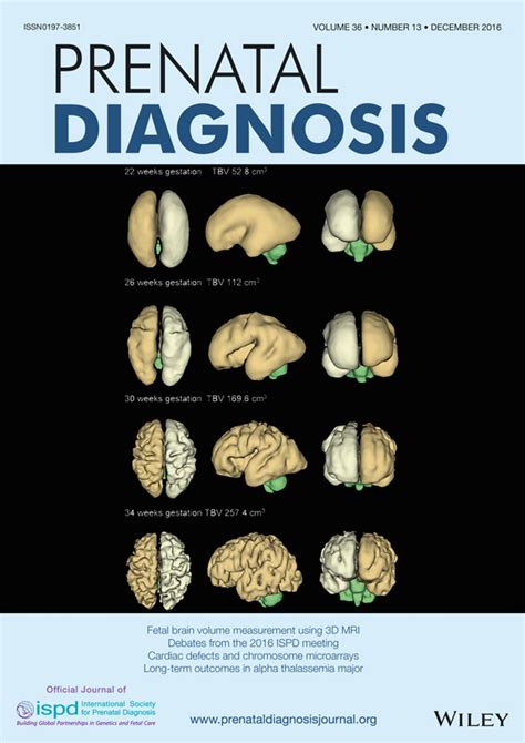 Clinical Aspects Of Prenatally Detected Congenital Heart Malformations And The Yield Of