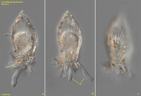 Cylindrifflugia Bacillariarum Real Micro Life