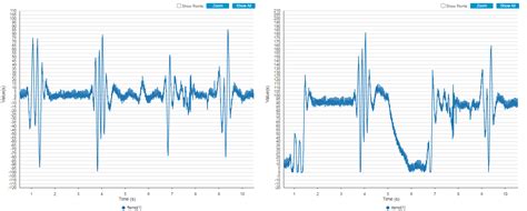 Implementation Of An Iir Filter With Integer Coefficients Signal