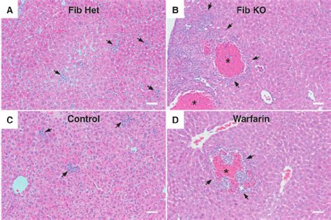 Fibrin Protects Against Infection Stimulated Hemorrhagic Pathology Download Scientific Diagram