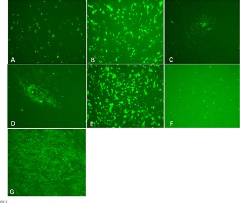Figure 2 From An Easy Method To Generate Recombinant Pseudorabies Virus Expressing The Capsid
