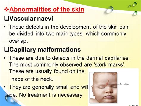 Congenital Cardiac Defects Ppt Video Online Download