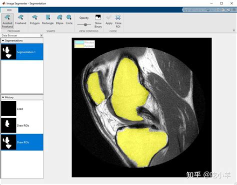MATLAB图像处理 使用图像分割器绘制区域来分割图像 知乎