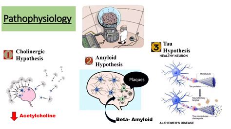 Screening Models Of Alzheimers Diseasepptx