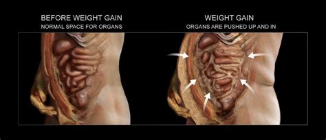 Ithy Unpacking Your Belly Bulge Beyond Just Fat