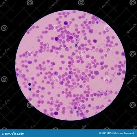 Reticulocyte Cartoons Illustrations And Vector Stock Images 46