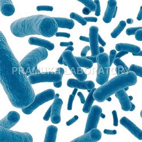Salmonella Dublin Testing Services At Rs 199 Sample In Ahmedabad Id 2855148805255