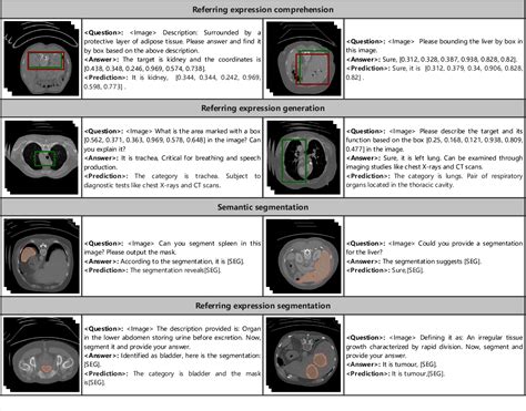 Figure 7 From M3d Advancing 3d Medical Image Analysis With Multi Modal Large Language Models