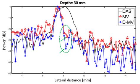 Double Minimum Variance Beamforming Method To Enhance Photoacoustic Imaging