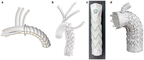 State Of The Art Review Of Aortic Arch Reconstruction With The Frozen