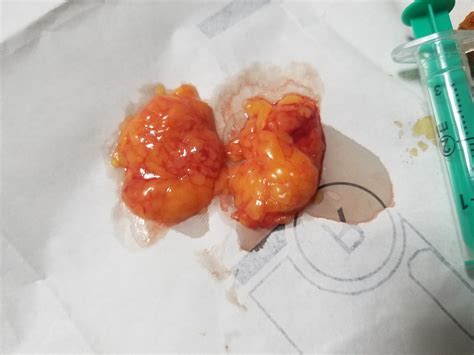 Dr Vakhtang Dr Vakhtang Meskhi • ყბა სახის ქირურგი