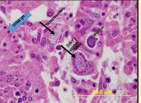 Intestinal Coccidia Flashcards Quizlet