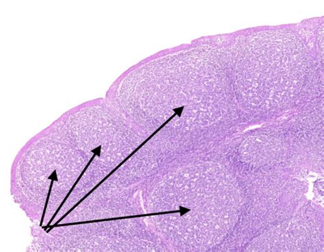 Lymphatic System Anatomy Flashcards Quizlet Lymphatic System Anatomy Flashcards Quizlet