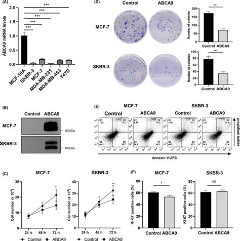 Abca9 Expression Is Suppressed In Breast Cancer Cells And Its