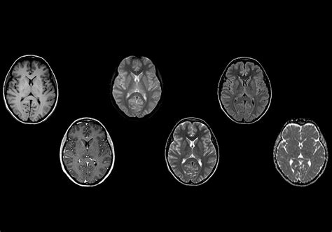 Axial Plane Brain