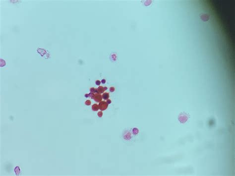 Csf Gram Stain R Medlabprofessionals