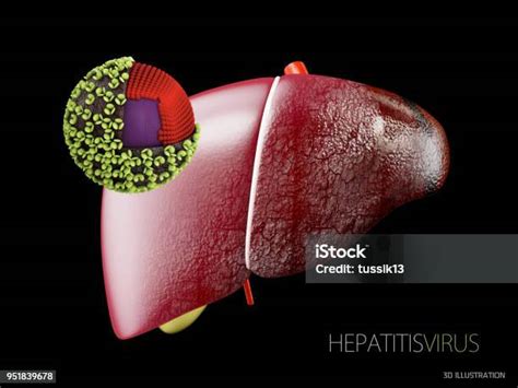 간염 바이러스와 간입니다 B 형 간염 바이러스의 구조입니다 3 차원 일러스트 레이 션 간염에 대한 스톡 사진 및 기타 이미지 간염 건강관리와 의술 과학 Istock