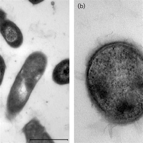 Electron Micrographs Of Cells Of Strain 9571414 J Bacterial