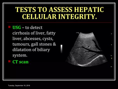 Liver And Gall Bladder Ppt