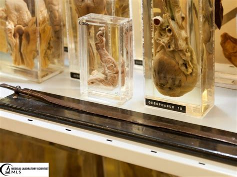 Fixation Ideal Fixative Factors Involved In Fixation Medical