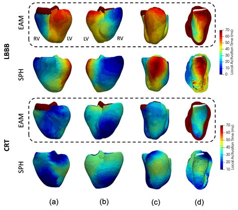 Applied Sciences Free Full Text Meshless Electrophysiological Modeling Of Cardiac