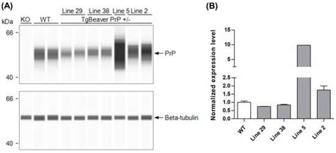 Biology Special Issue Selective Vulnerability In Neurodegenerative Diseases
