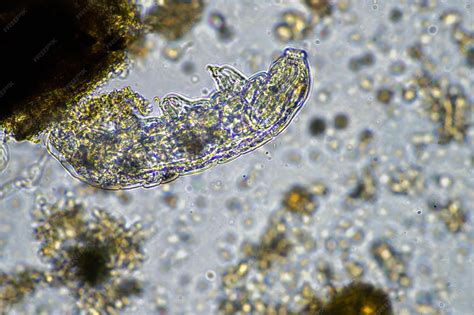 Premium Photo Human Parasite Gut Intestinal Infection Disease