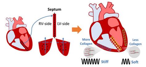 Interventricular Septum Histology