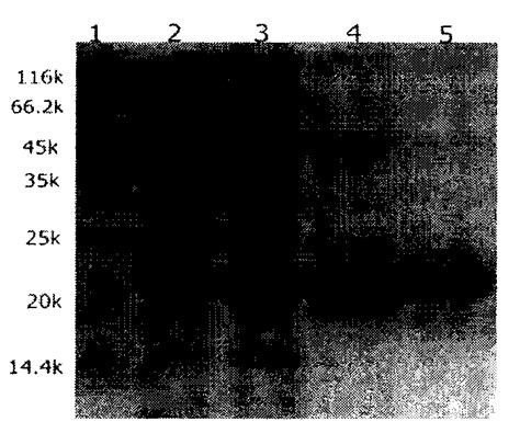 Recombinant Plancenta Hominis Globin Renaturation And Medicine