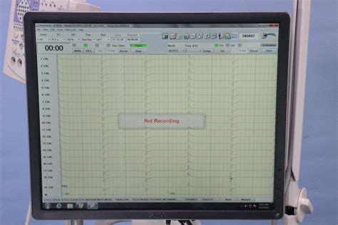 Used Nihon Kohden Neurofax Eeg Unit For Sale Dotmed Listing 4756120
