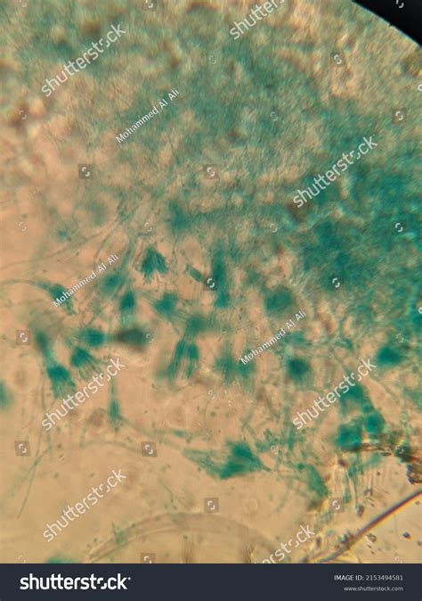 Ootage Demodex Face Mites Under Microscope Foto Stock 2153494581 Shutterstock